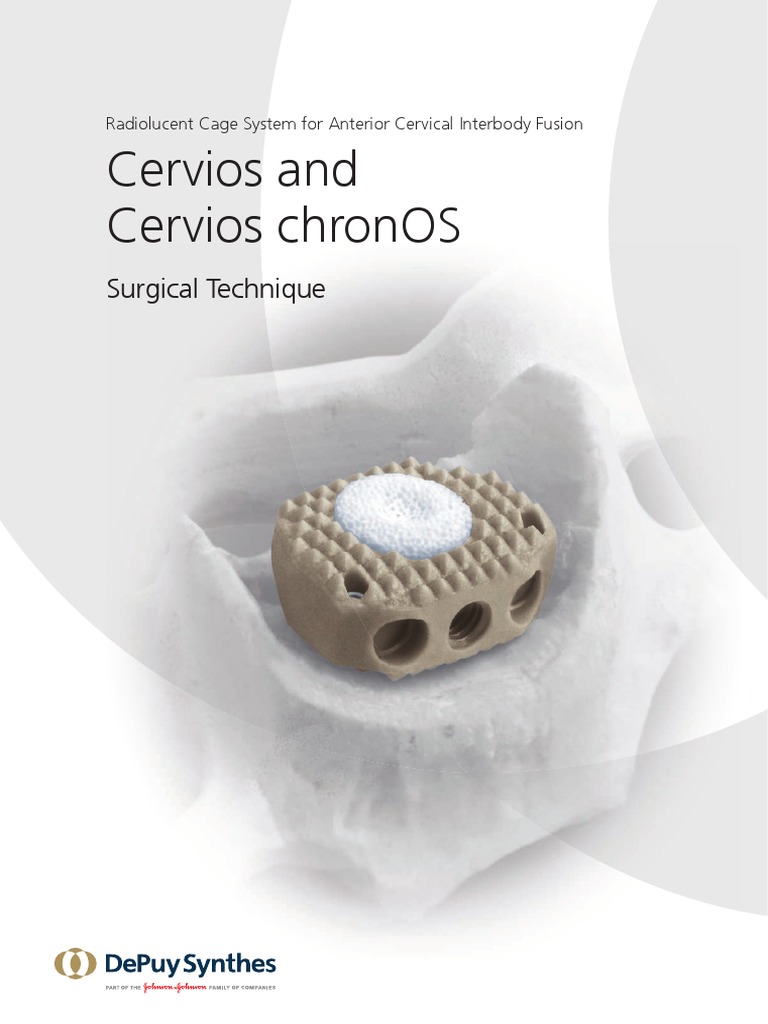 Cervios and Cervios ChronOS Technique Guide - DSEMSPN091401732 | PDF