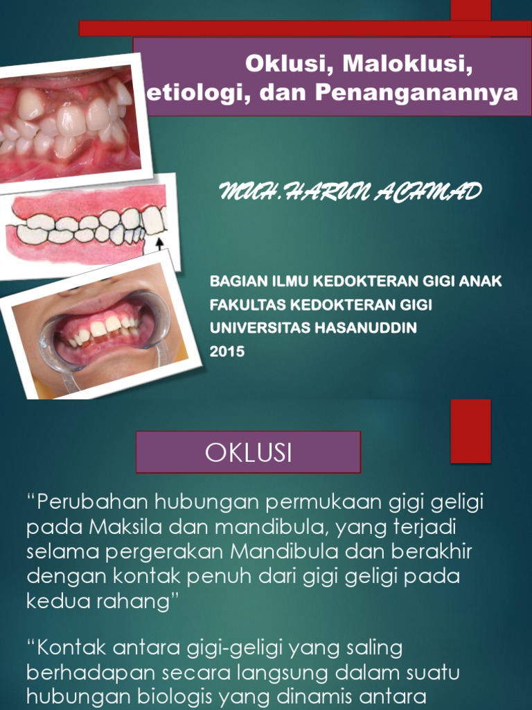 Oklusi dan Maloklusi Gigi Anak | PDF