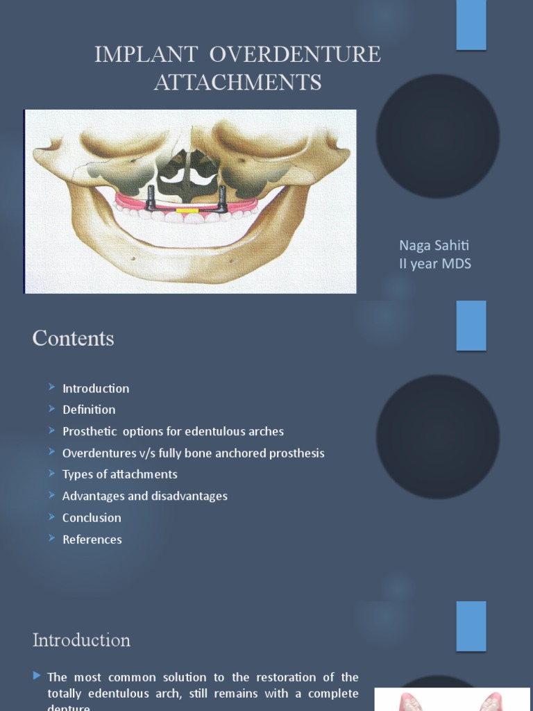 Implant Overdenture Attachments | PDF | Dental Implant | Dentistry Branches
