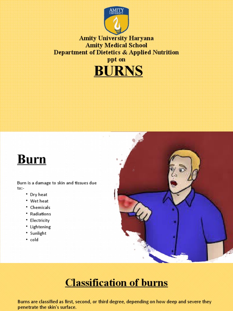 Nutritional Management of Burns | PDF | Burn | Fat