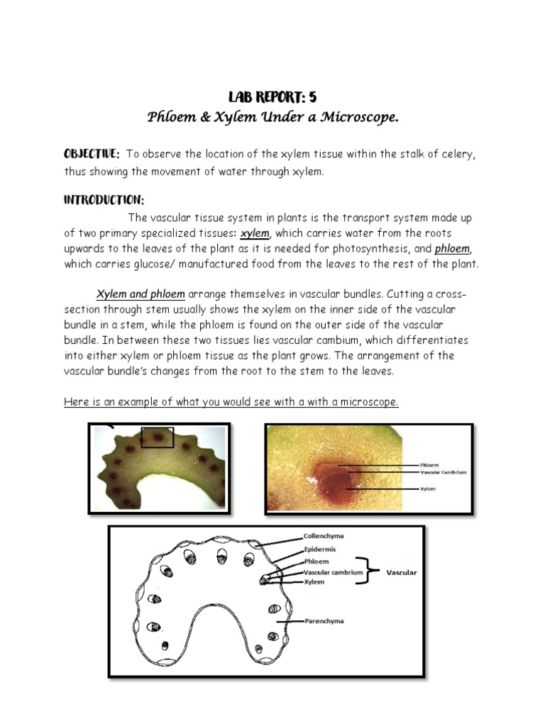 Lab Report - Phloem & Xylem | PDF | Plant Stem | Tissue (Biology)