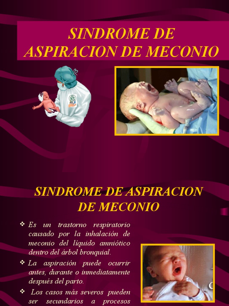 Síndrome de Aspiración de Meconio | PDF | Especialidades Medicas ...