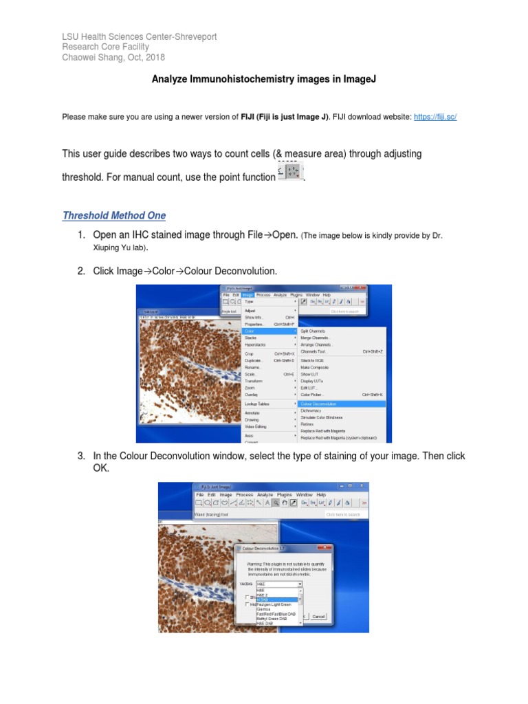 Analyzing Immunohistochemistry Images in ImageJ: Two Thresholding Methods for Cell Counting and ...