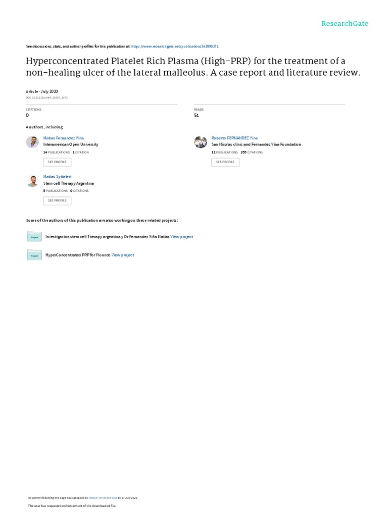 Hyperconcentrated Platelet Rich Plasma High PRP For The Treatment of A ...