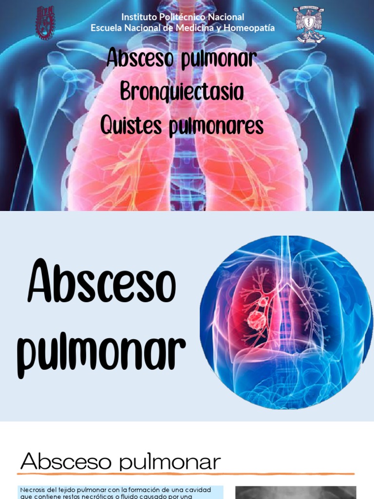 Absceso Pulmonar | PDF | Tos | Neumología