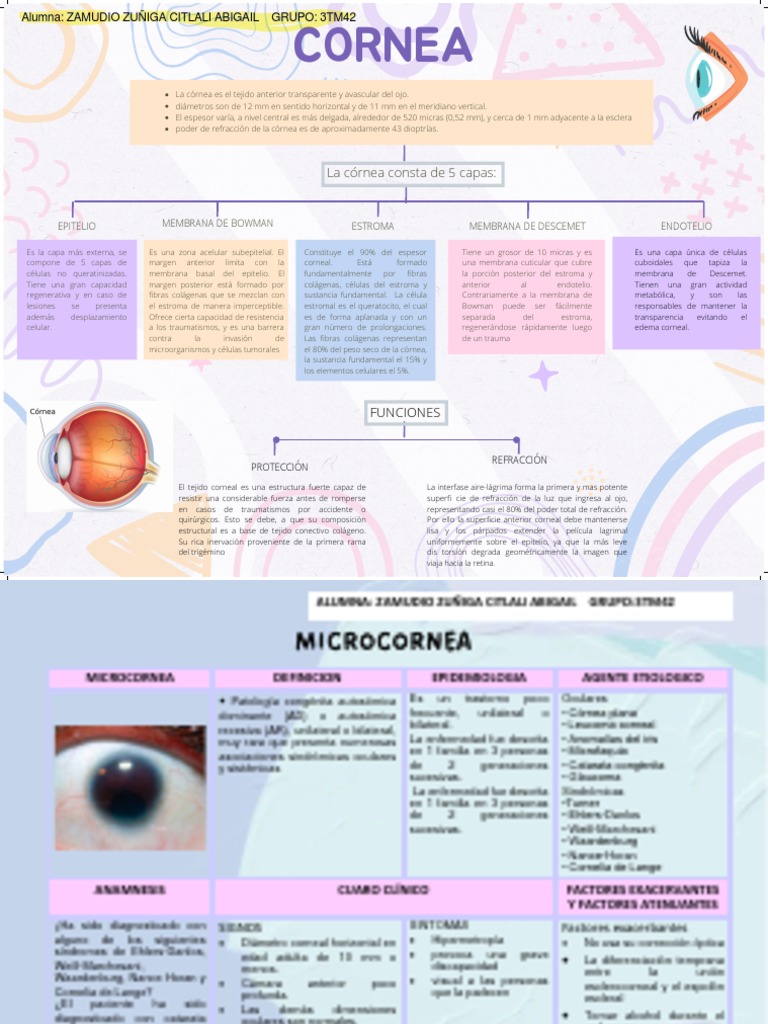 Microcornea | Descargar gratis PDF | Córnea | Glaucoma