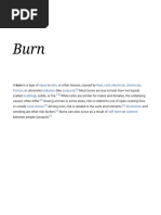 Wallace Rule of Nines | PDF | Burn | Intravenous Therapy