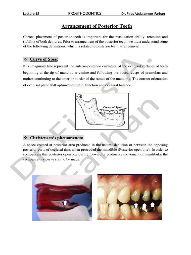 Principles of Posterior Teeth Arrangement | PDF | Tooth | Human Head ...