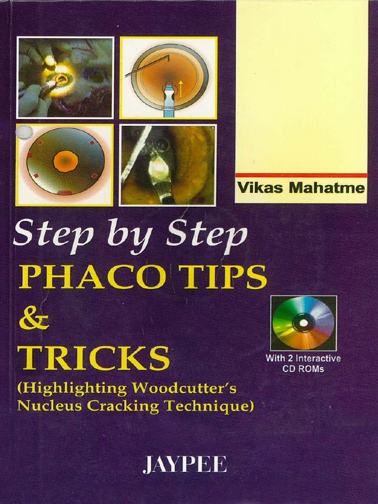 Step by Step Phaco Tips and Tricks | PDF