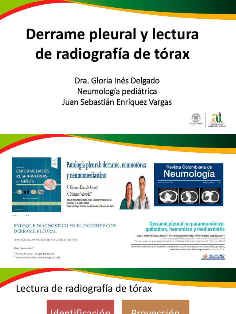 Derrame Pleural y RX Tórax | PDF | Sistema respiratorio | Medicina
