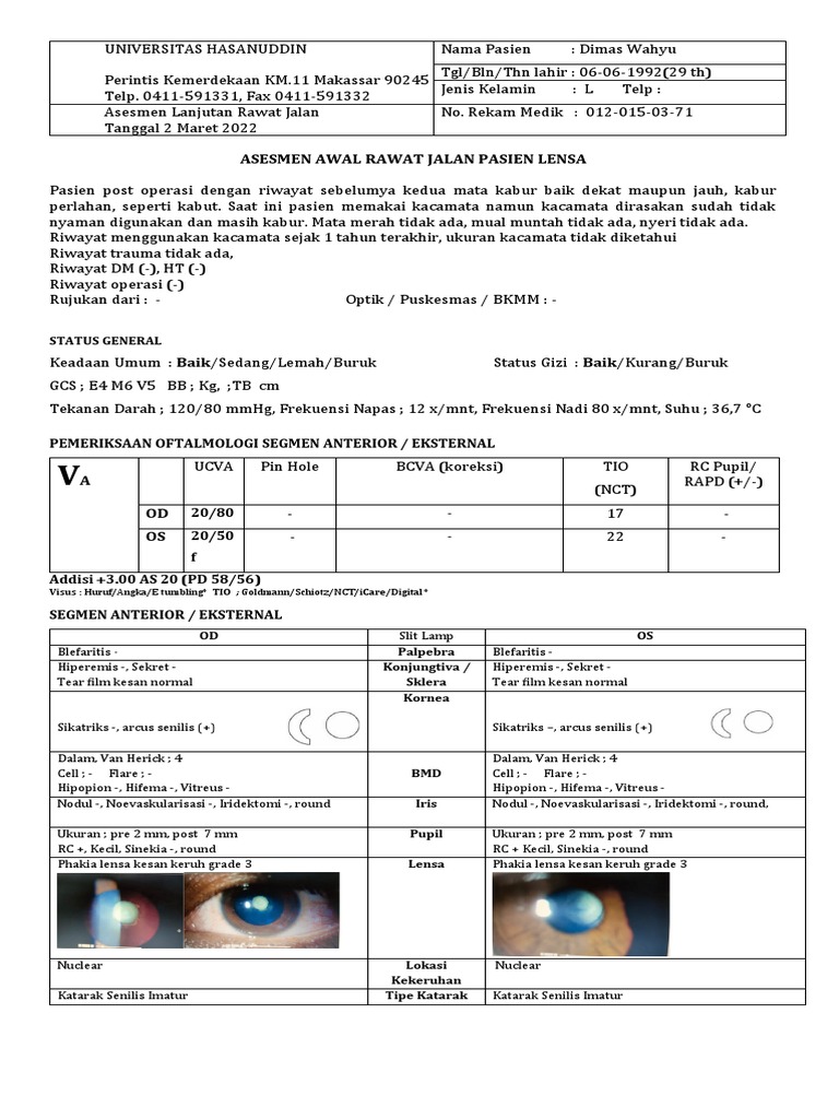 K107. HZ-Dimas Wahyu - 012-015-03-71 - OD Katarak Senilis Imatur, OS Pseudophakia | PDF