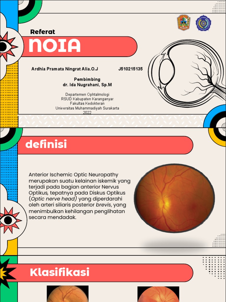 Neuropati Optik Iskemik Anterior (NOIA) - REFERAT | PDF | Epidemiologi ...