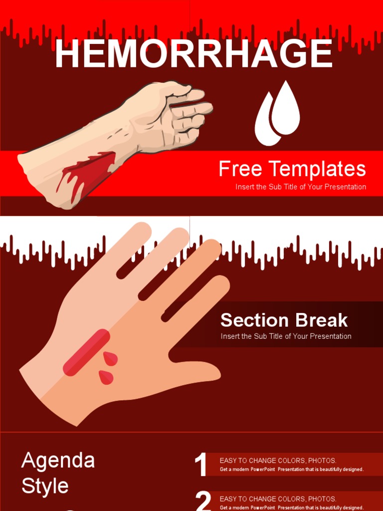 Hemorrhage: Free Templates | PDF | Heart Valve | Thorax (Human Anatomy)