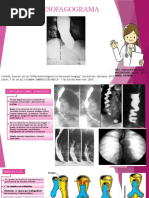 Triangulo de Farabeuf | PDF | Anatomía humana | Cabeza y cuello humanos
