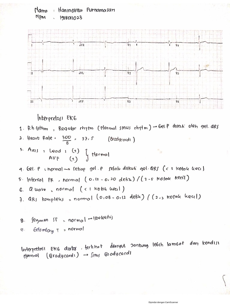 Interpretasi EKG | PDF