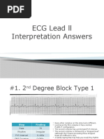 Basic EKG ECG Rhythms Cheatsheet | PDF | Electrocardiography | Cardiac ...