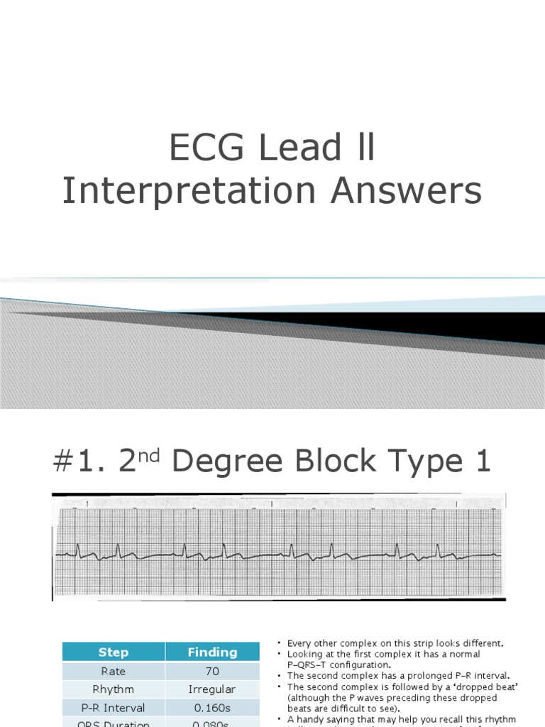 ECG Lead LL Interpretation Answers | PDF | Electrocardiography ...