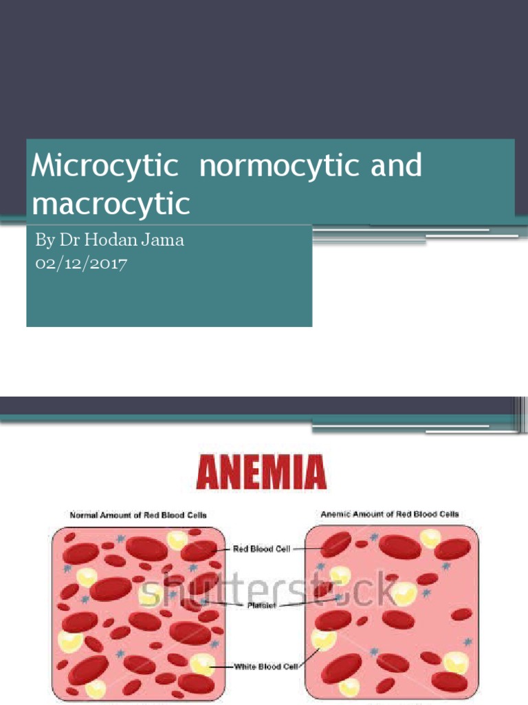 Microcytic Normocytic and Macrocytic: by DR Hodan Jama 02/12/2017 ...
