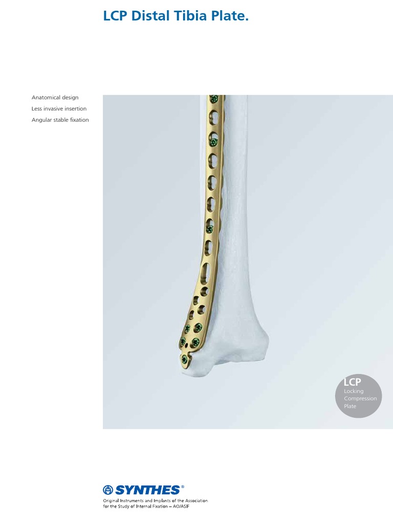 Anatomical Design Less Invasive Insertion Angular Stable Fixation ...