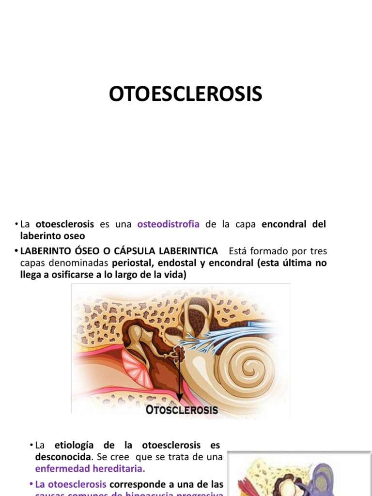 OTOESCLEROSIS | PDF | Medicina CLINICA | Otología