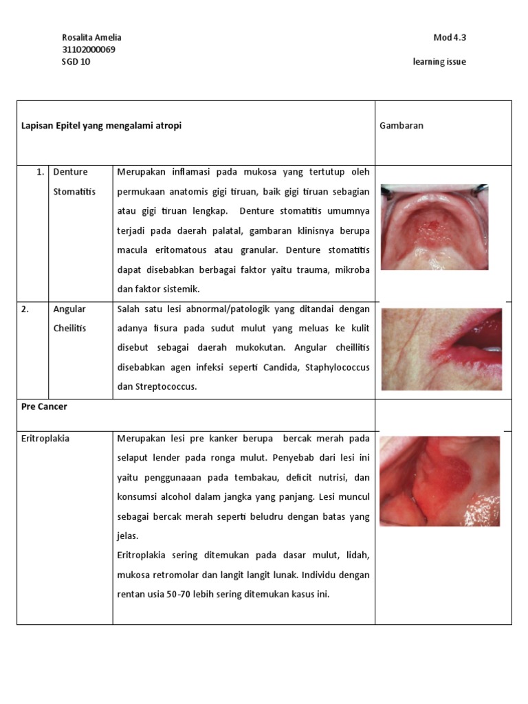 Learning Issue LBM 1 | PDF