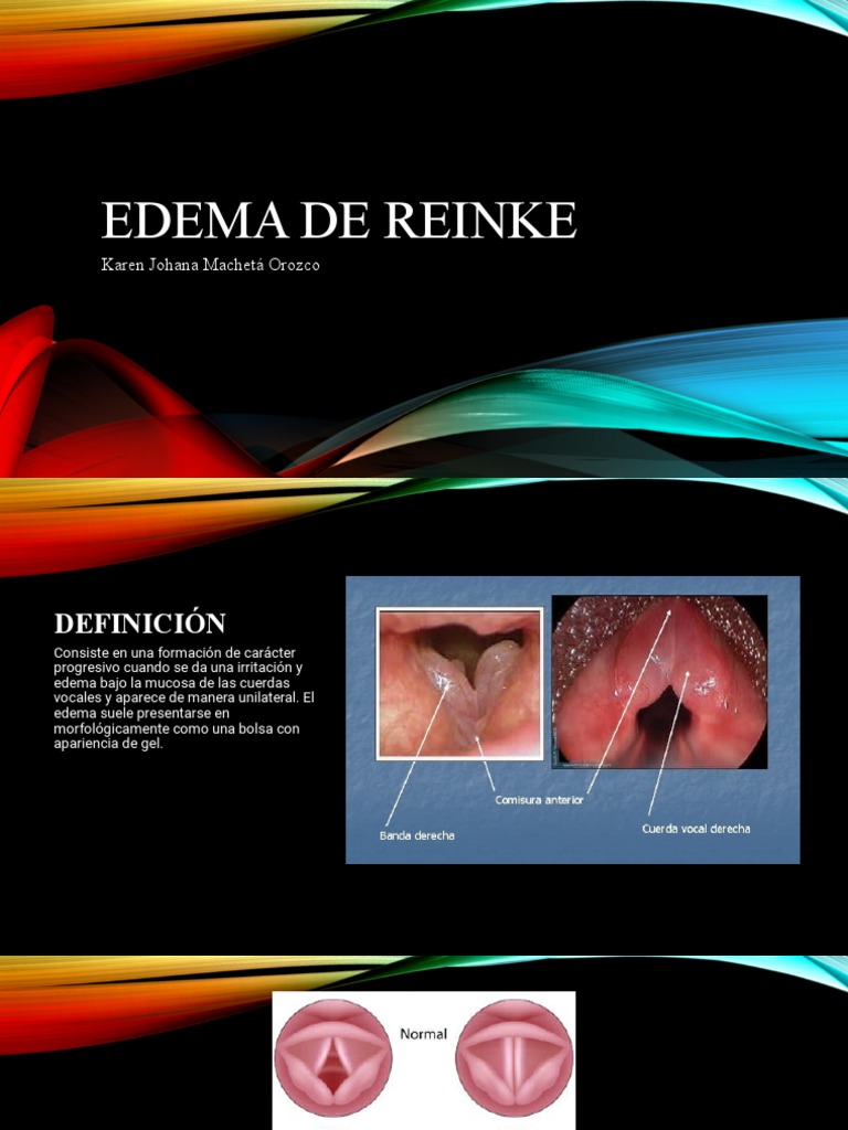 Edema de Reinke: Definición y Tratamiento | PDF | Ciencia y matemáticas