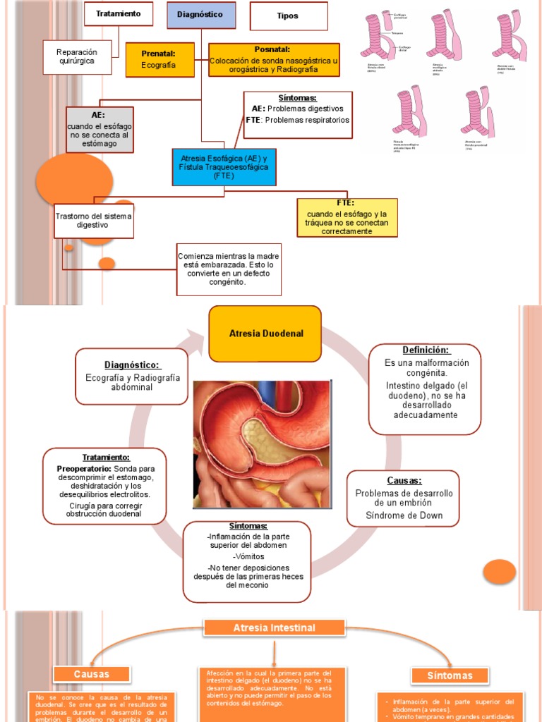 Atresia Intestinal | PDF | Heces | Tracto gastrointestinal