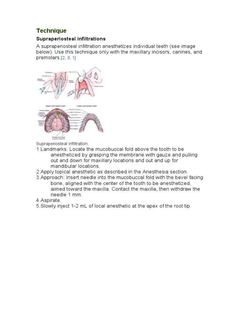 Technique: Supraperiosteal Infiltrations | Download Free PDF | Face | Mouth