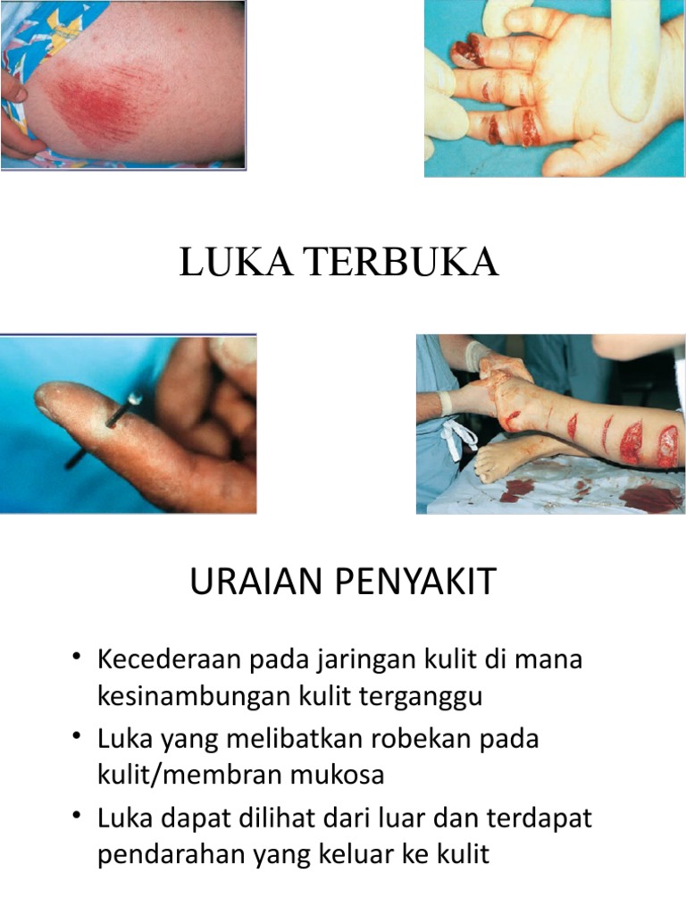 Luka Terbuka | PDF | Pengembangan Diri | Kesehatan Holistik