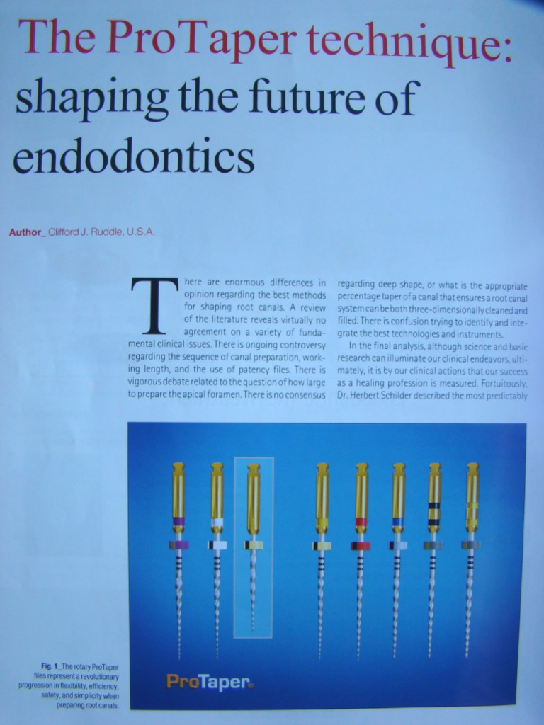 The Protaper Technique Shaping The Future of Endodontics - Clifford ...