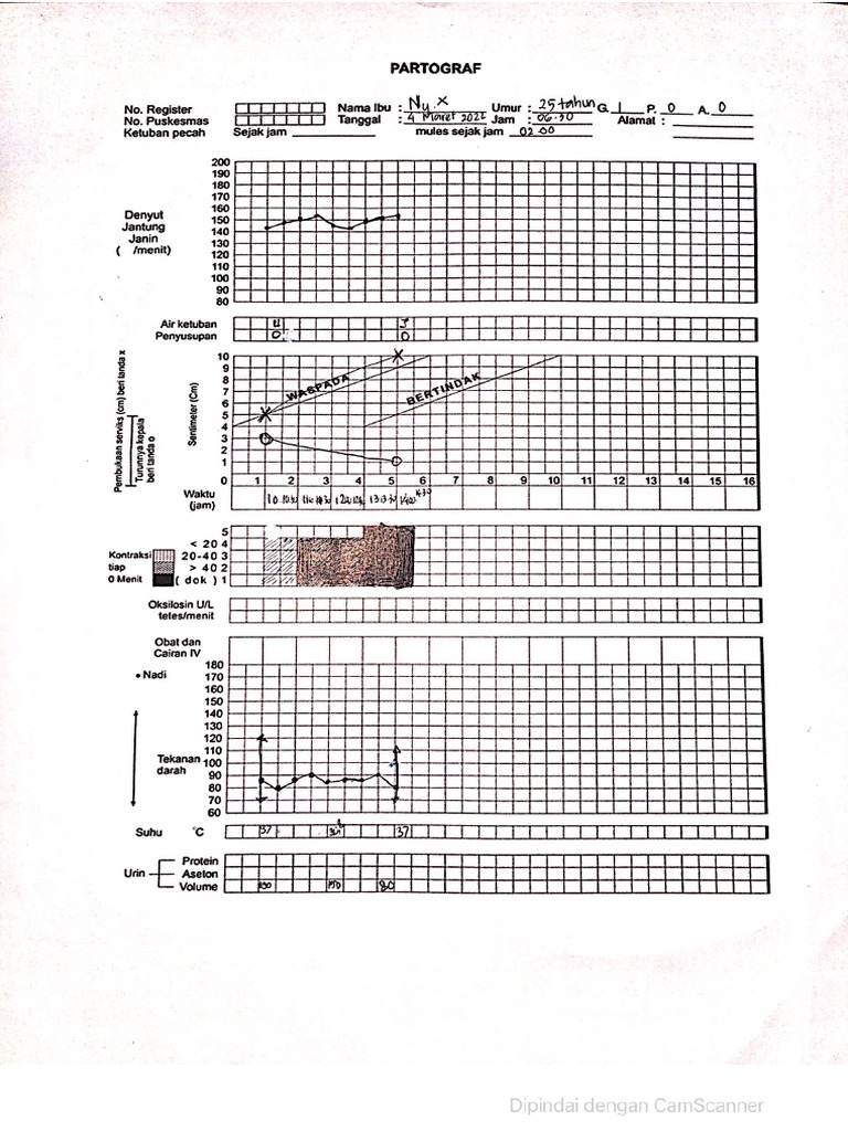 Partograf 2 | PDF