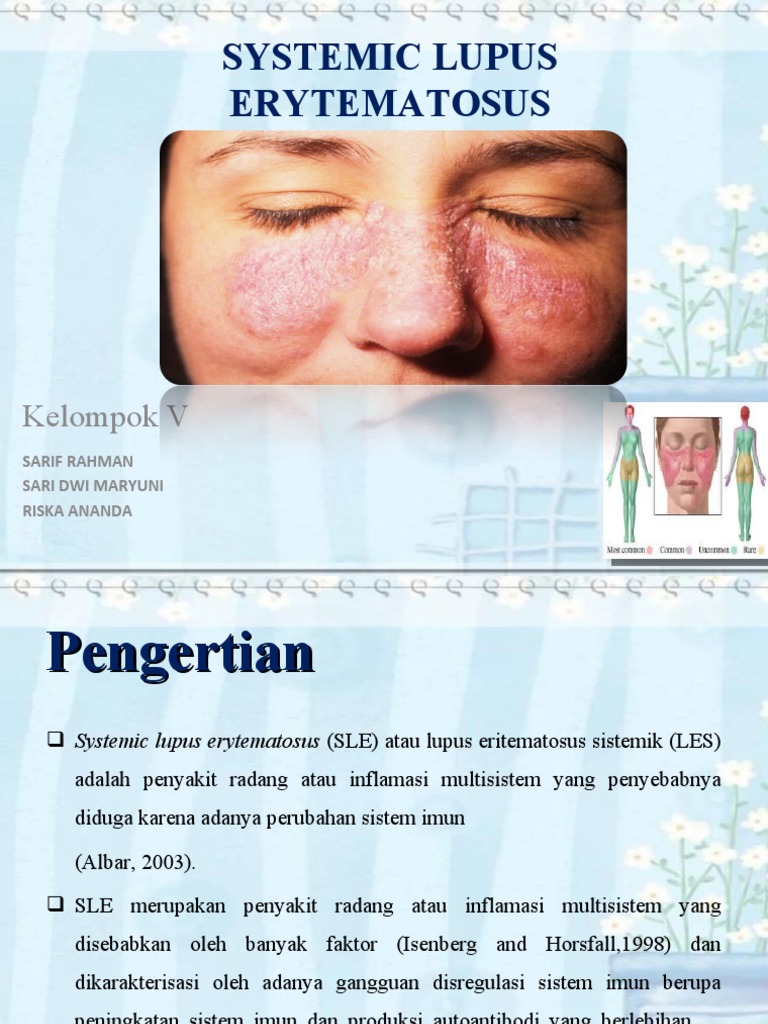 Panduan Lengkap Systemic Lupus Erythematosus | PDF
