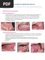 Revisión del Leucoedema Oral | PDF | Epitelio | Biología Celular)