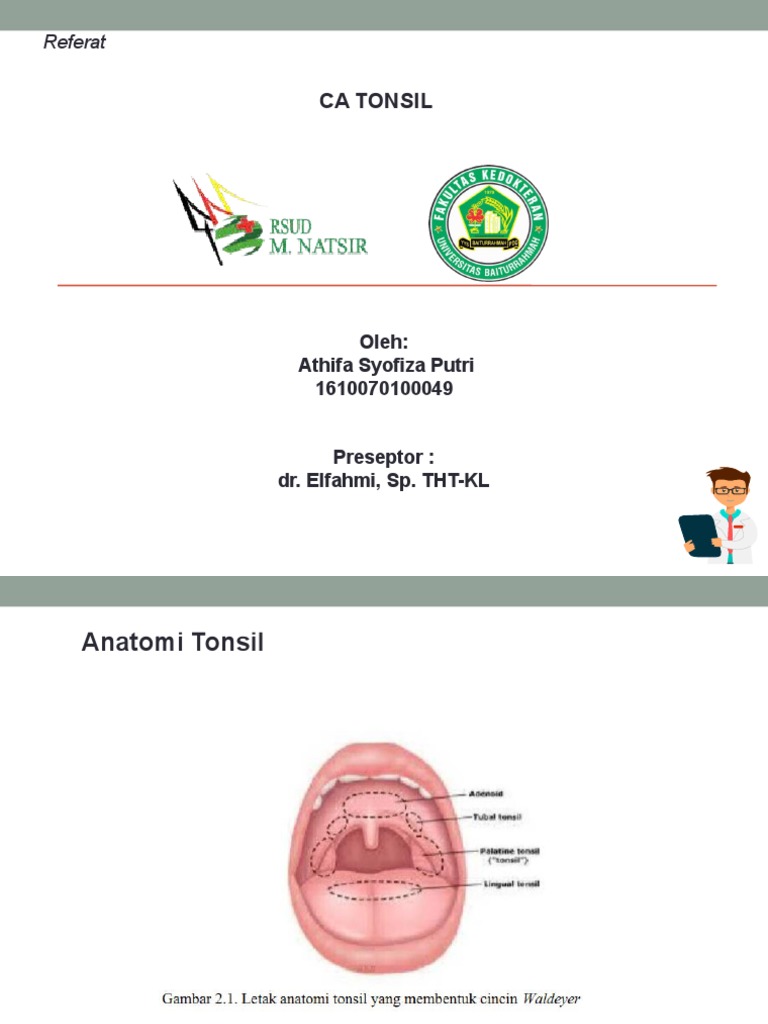 Ca Tonsil Thifa | PDF