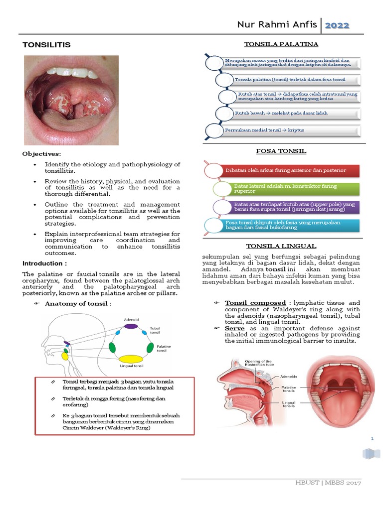 Tonsilitis | PDF