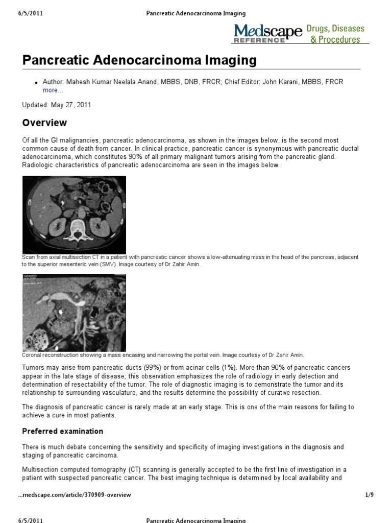 Pancreatic Adenocarcinoma Imaging | PDF | Pancreatic Cancer | Magnetic ...