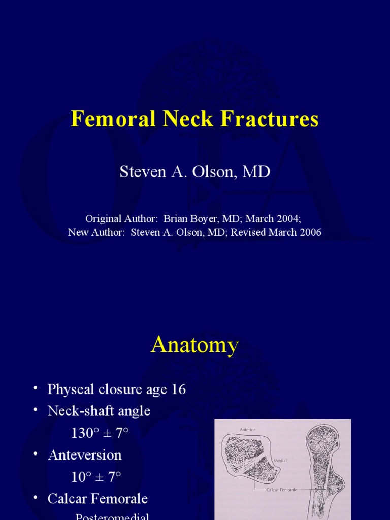 Femoral Neck Fractures: Overview & Treatment | PDF | Diseases And ...