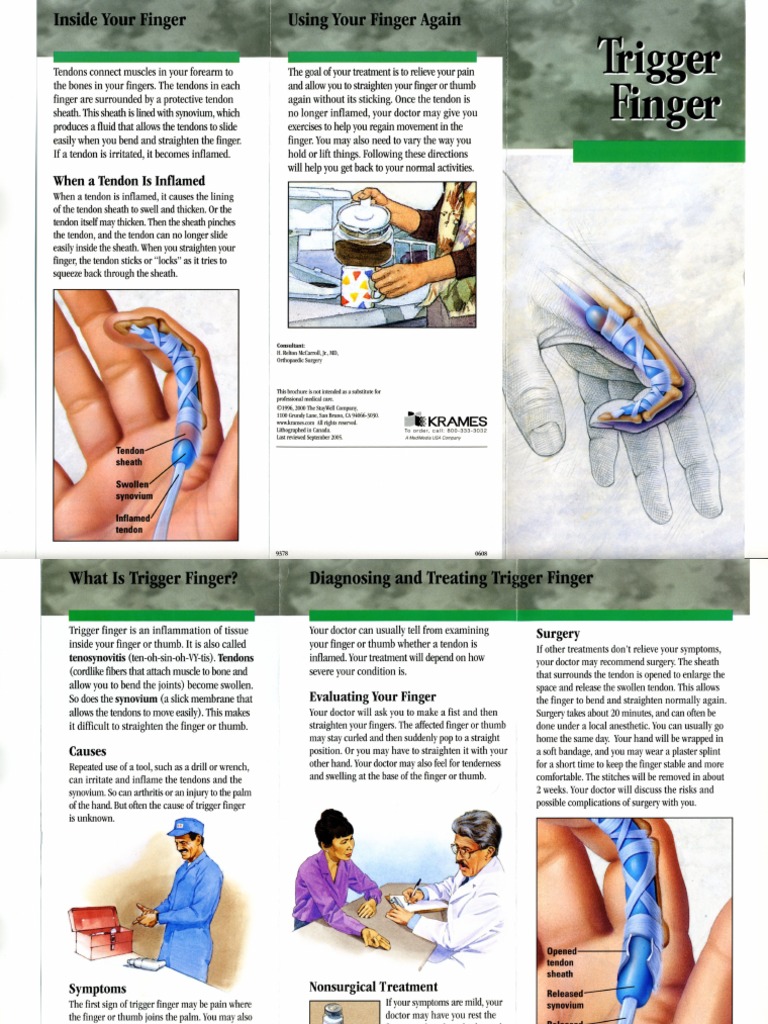 Trigger Finger Brochure - Hand Center | PDF