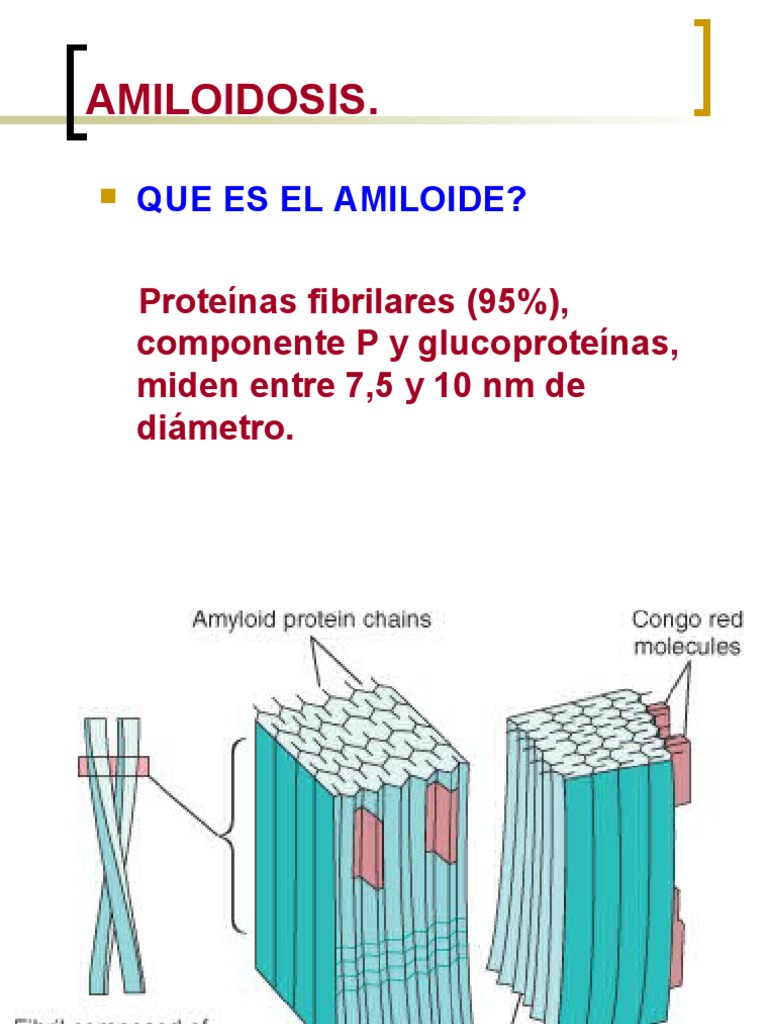 AMILOIDOSIS | PDF | Especialidades Medicas | Medicina CLINICA