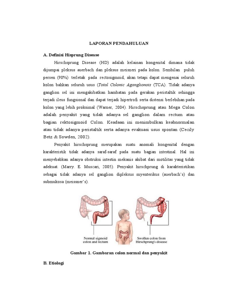 LP Hisprung Disease | PDF