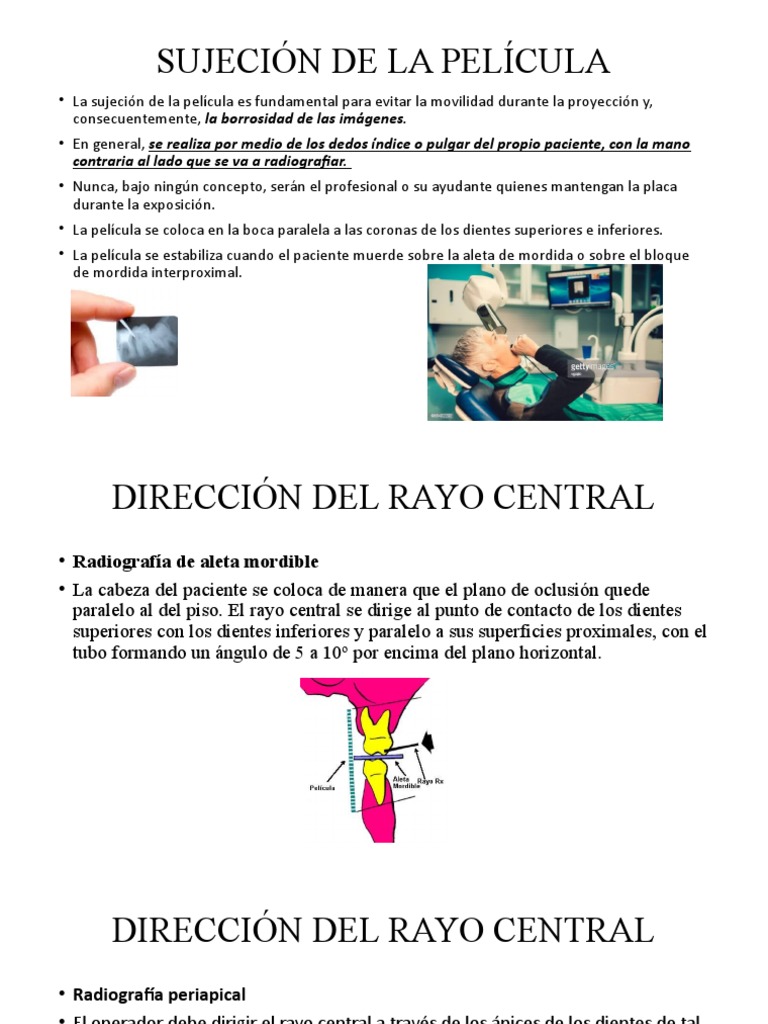 Sujeción de La Película y Dirección Del Rayo Central | PDF | Salud y ...