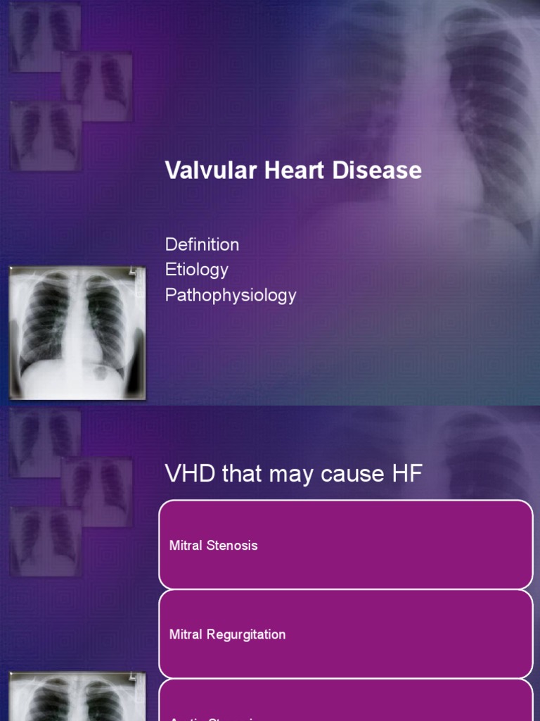 Valvular Heart Disease: Etiology Pathophysiology | PDF | Heart Valve ...