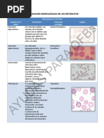 Variaciones Eritrocitarias y Causas | PDF | Medicina CLINICA | Biología ...