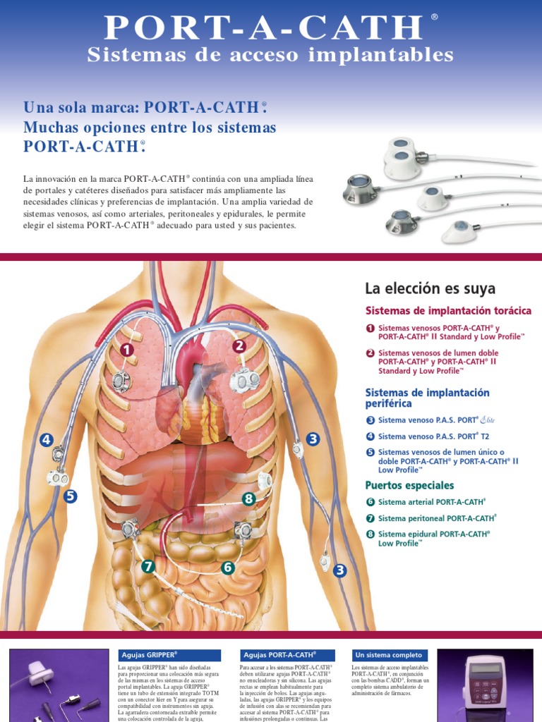 Poster Portacath | PDF | Inyección (medicina) | Enfermedades y trastornos