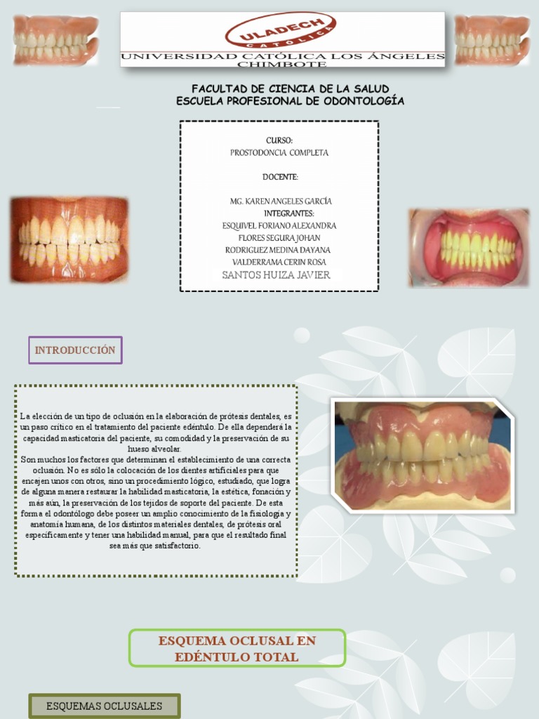Esquemas Oclusales en Prótesis Total | PDF