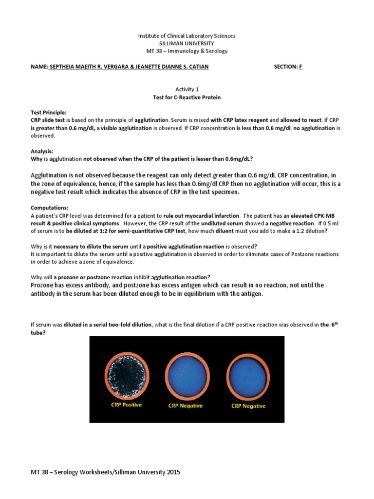 CRP Worksheet | PDF | C Reactive Protein | Immunology