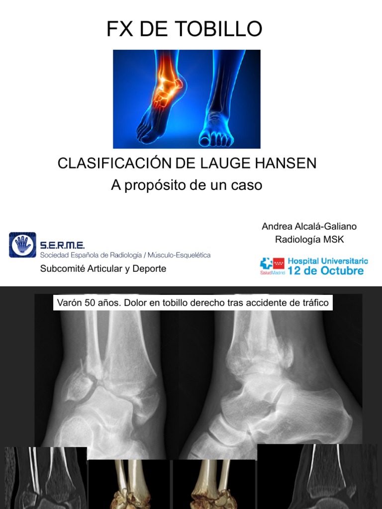 Lesiones de Tobillo | PDF | Tobillo | Pie