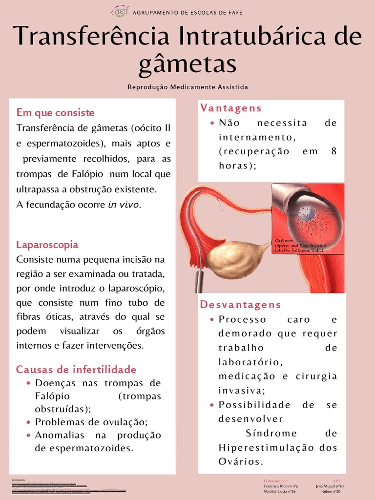 Transferência Intratubária de Gametas | PDF | Reprodução humana ...