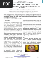 USPHS Criteria | PDF