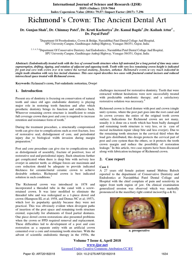 Restoring Function and Esthetics with Richmond's Crown: A Case Report ...